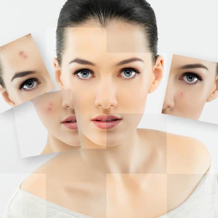 Narben im Gesicht kaschieren