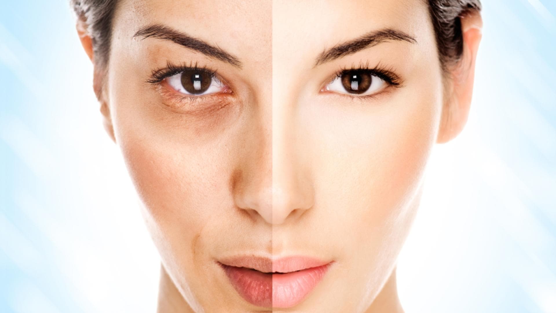 Jünger aussehen dank Bio-Lifting